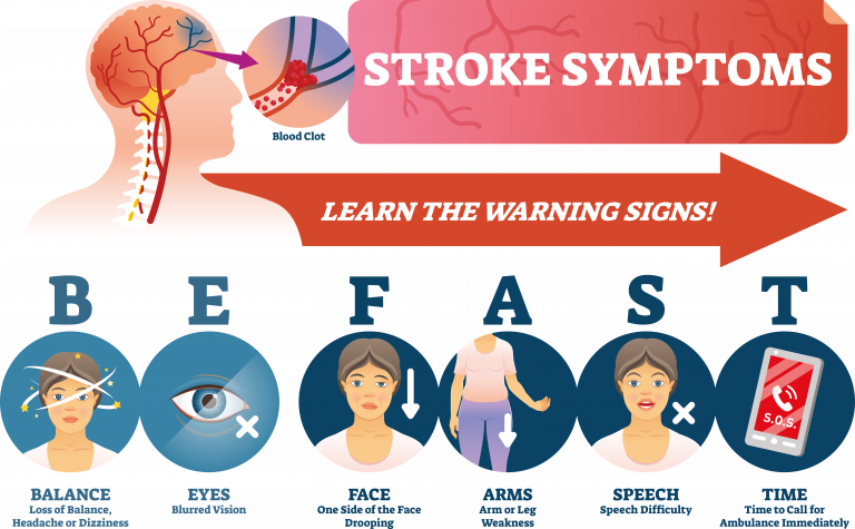 Stroke - "BEFAST" - High Peak First Aid